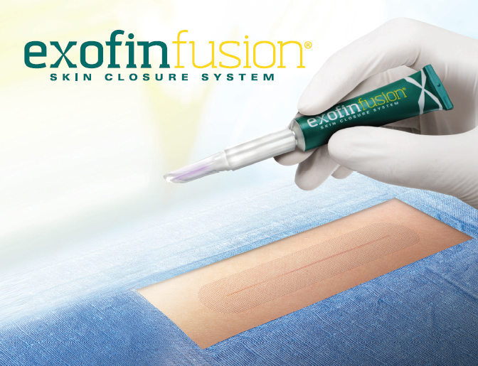 Medical Oxygen Concentrator Sellers & Suppliers Malaysia | Oxygen ...